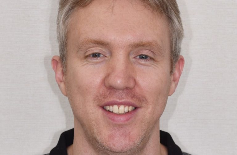 Invisalign.Post.Op..2.000 (2) - Rockefeller Dental Group